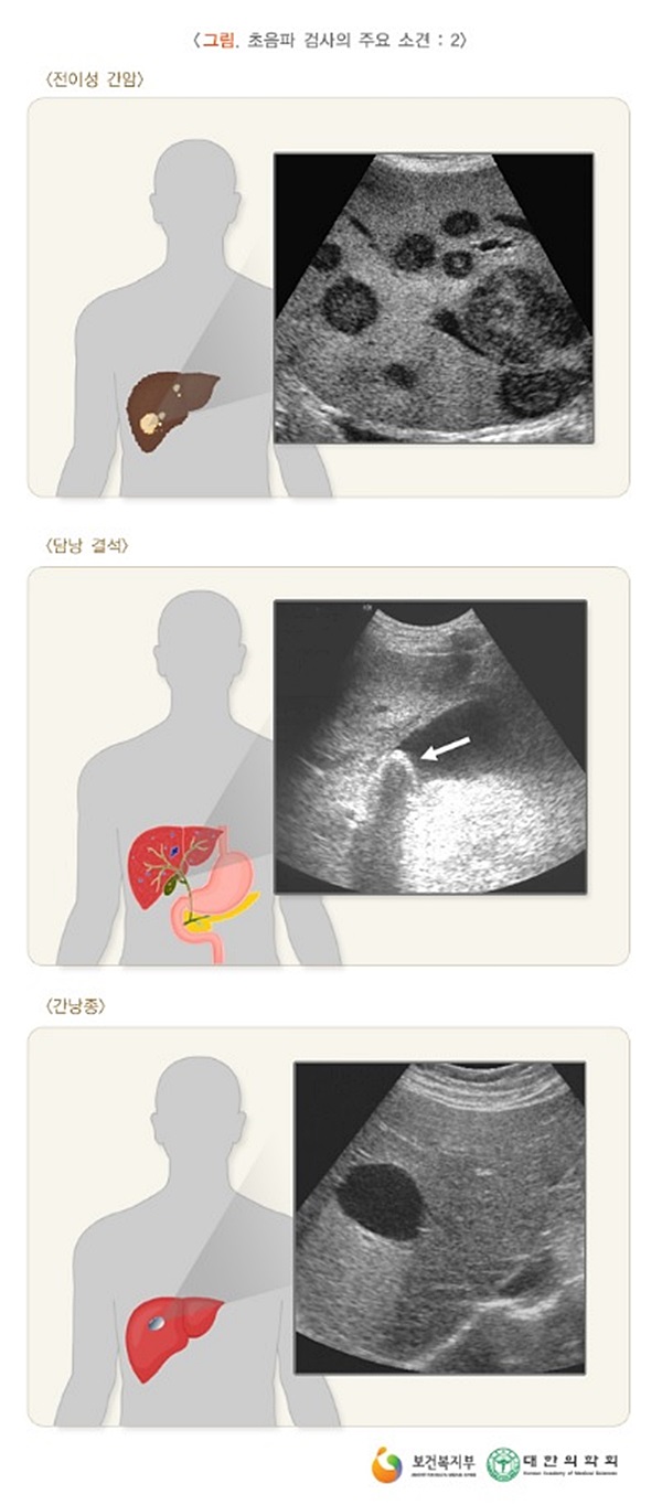 마디사랑병원 Community Blog