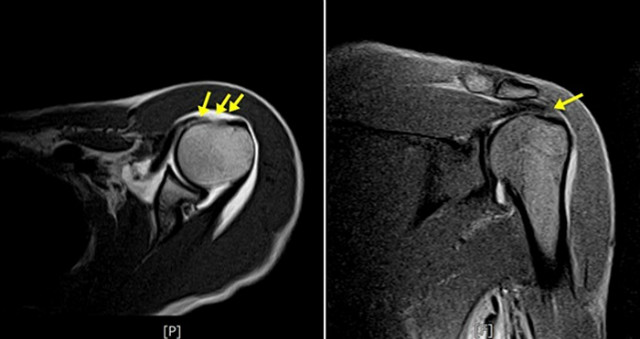 마디사랑병원 - Community > Blog