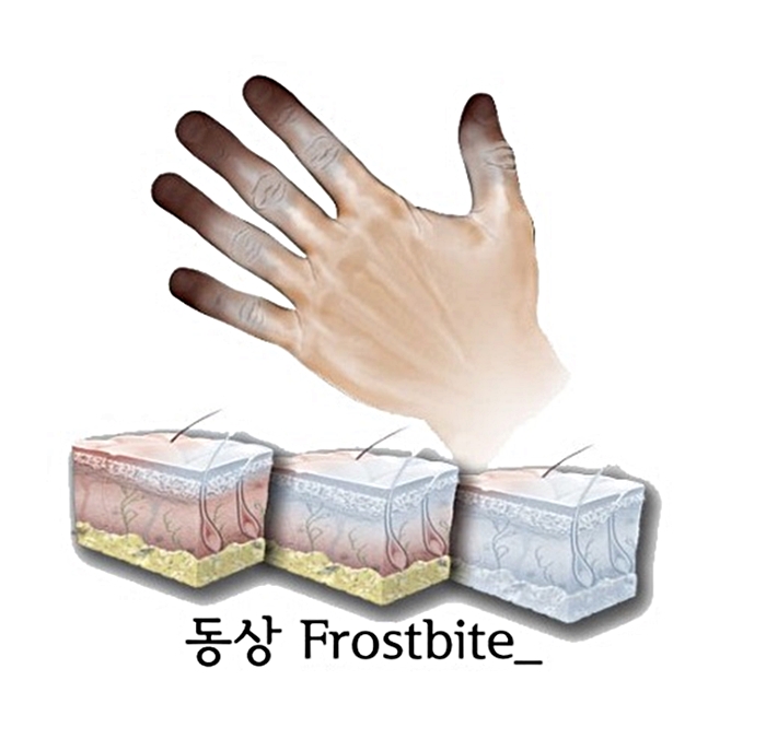 마디사랑병원 - Community > Blog