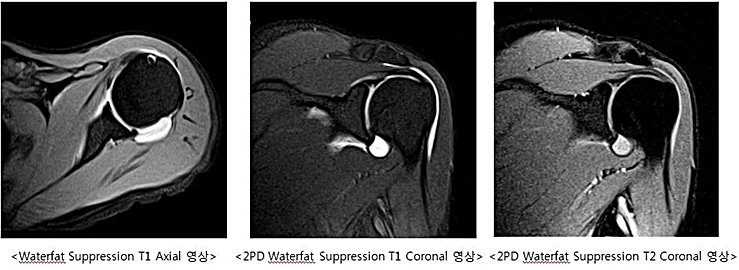 마디사랑병원 - Community > Blog